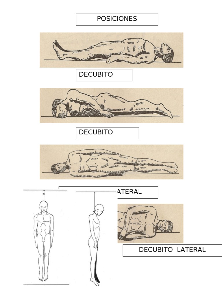 POSICIONES CADAVERICAS