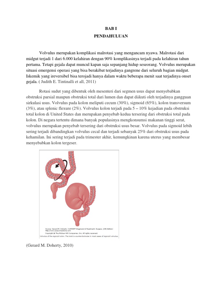 Penyebab dan Definisi Volvulus Usus | PDF | Ilmu Sosial | Kesehatan ...