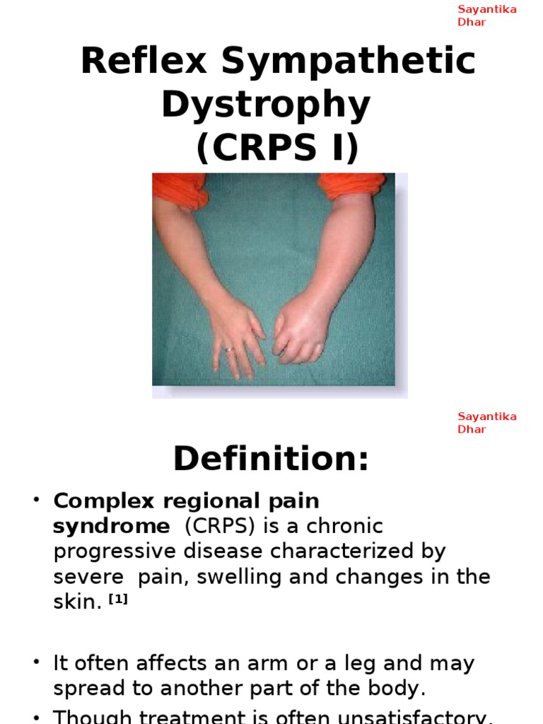 Reflex Sympathetic Dystrophy, CRPS-1 | PDF | Pain | Clinical Medicine