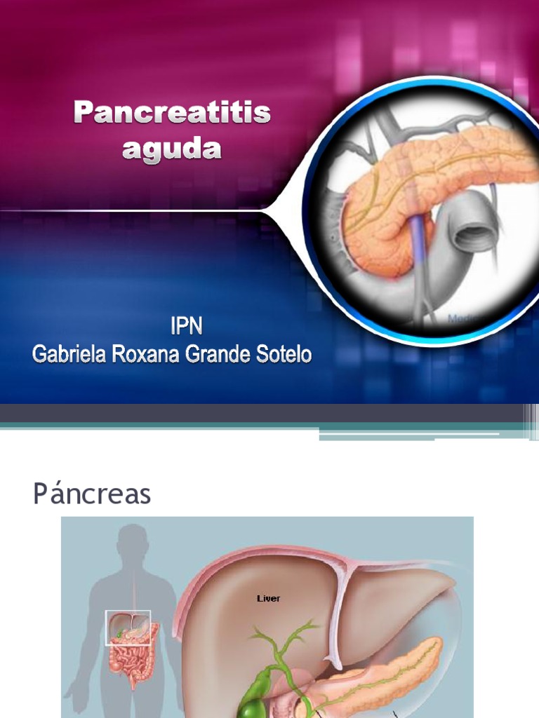 Pancreatitis Aguda | PDF | Páncreas | Abdomen