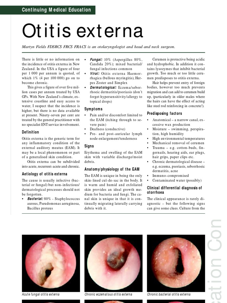 Otitis Externa Guidelines – Otitis Externa Symptoms – ILSZ
