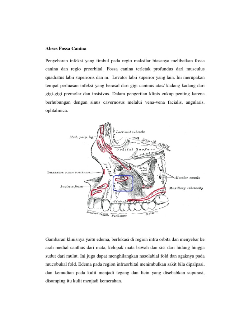 Abses Fossa Canina | PDF