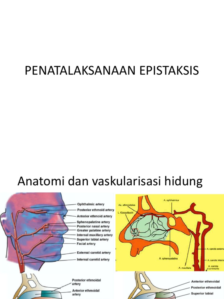 Panduan Penatalaksanaan Epistaksis | PDF | Kesehatan Holistik