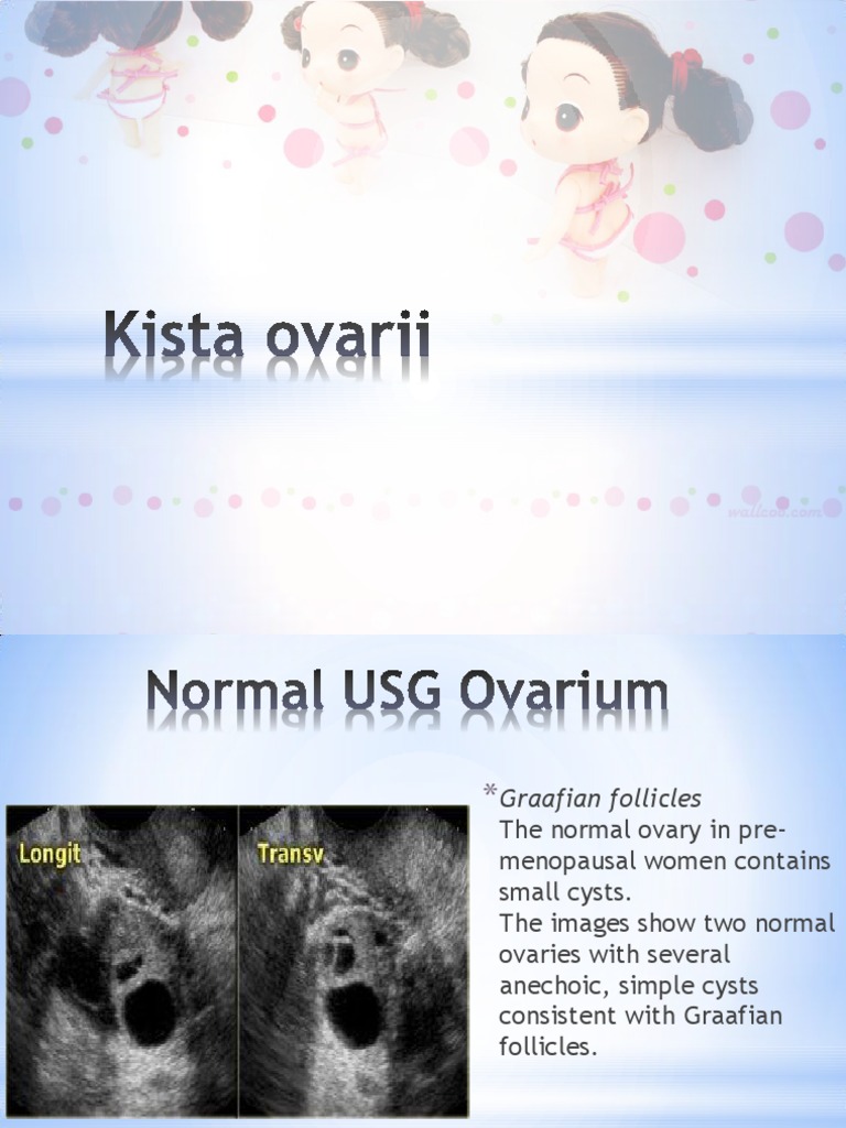 Kista Ovarii & Ginjal (USG&CTscan) | PDF | Medical Ultrasound | Ovarian ...