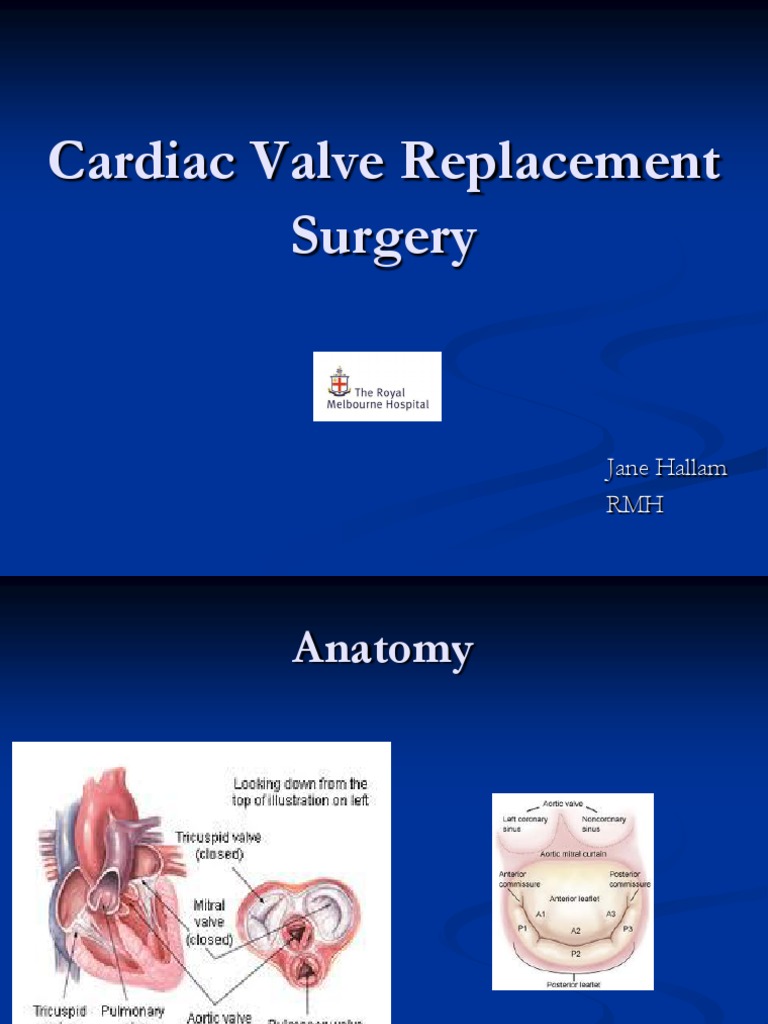 Cardiac Valve Replacement Surgery | PDF | Heart Valve | Blood Pressure