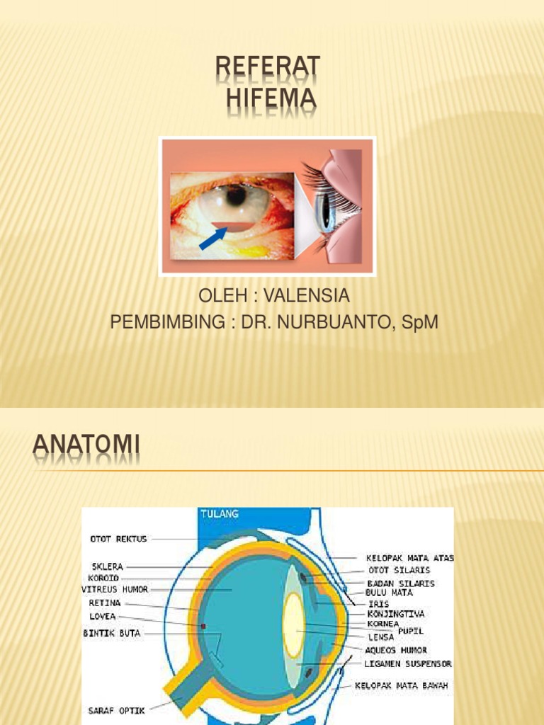 Hifema Grade 1: Definisi dan Penanganan | PDF | Sains & Matematika