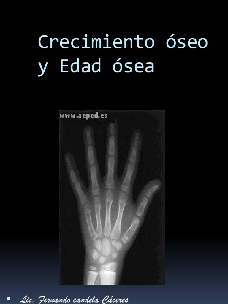 Edad Osea y Crecimiento Oseo | PDF | Hueso | Extremidades (anatomía)