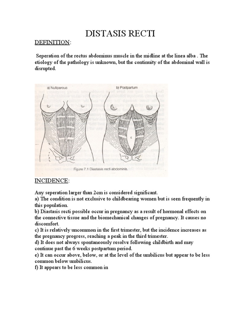Diastasis Recti: Ab Separation During Pregnancy | PDF | Abdomen | Pelvis