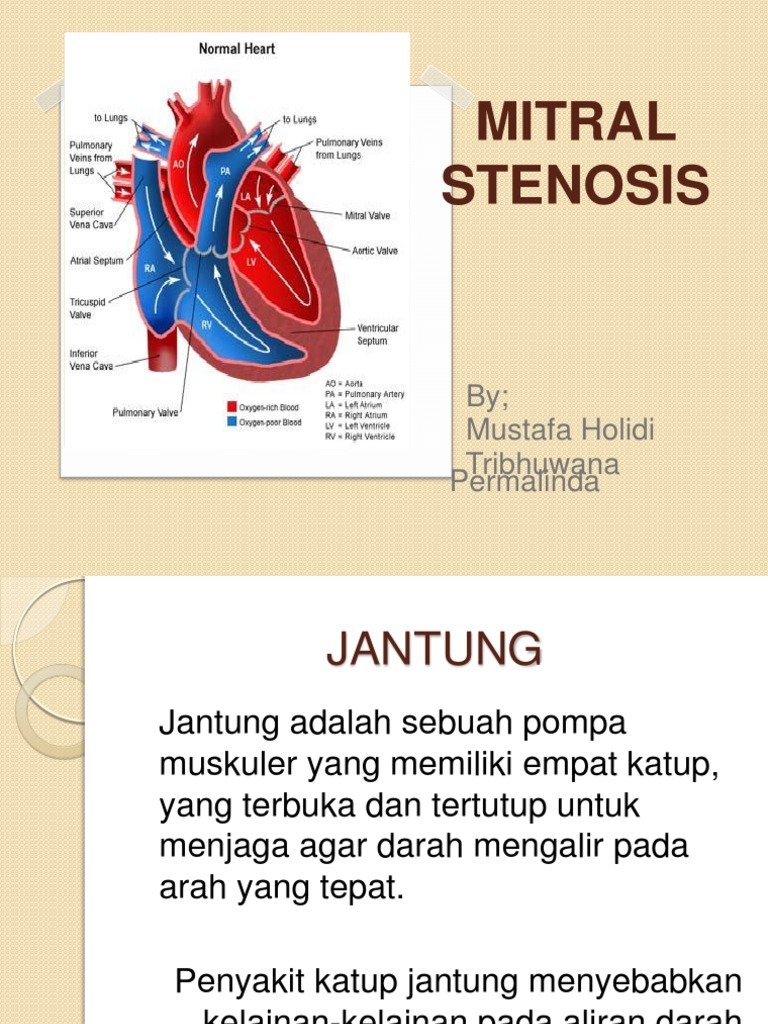 Mitral Stenosis | PDF