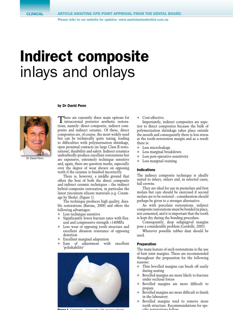Indirect Composite Inlays and Onlays | PDF | Dental Composite | Tooth ...