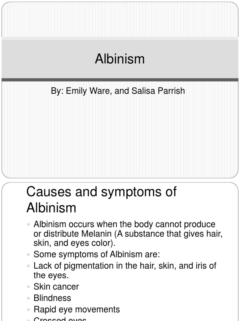Understanding Albinism: Causes & Symptoms | PDF