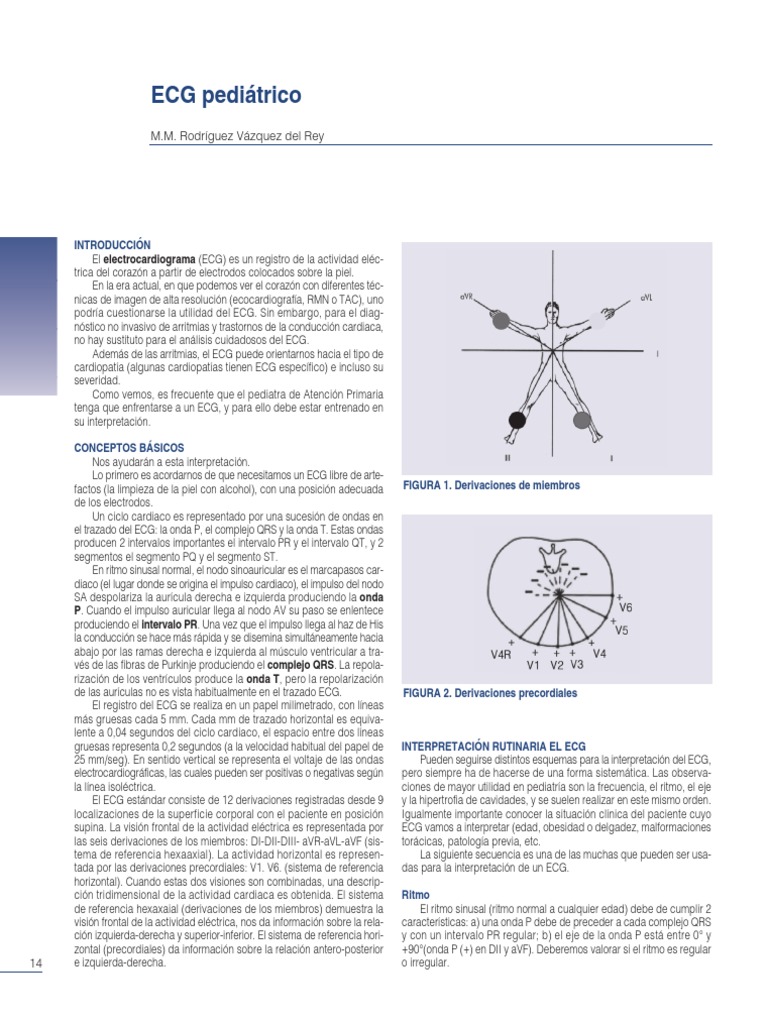 Talleres ECG Pediatrico | PDF | Electrocardiografia | Arritmia cardiaca
