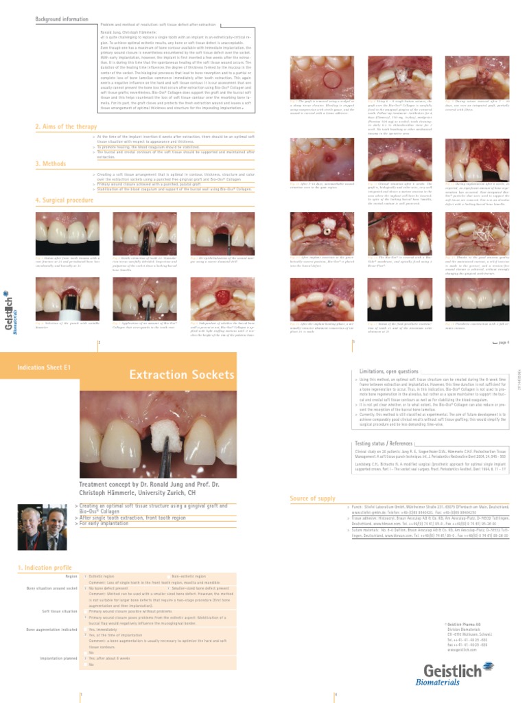 E1 - Extraction Sockets | PDF | Dental Implant | Medical Specialties
