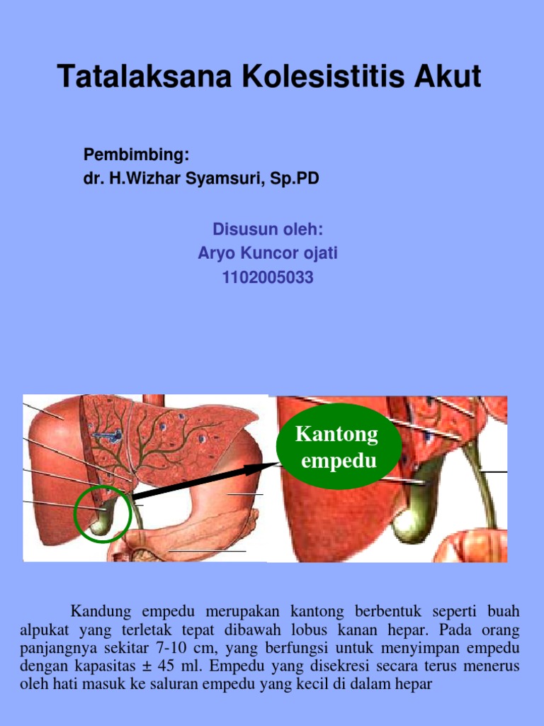 Penatalaksanaan Kolesistitis Akut | PDF
