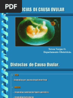 Distocia Funicular: Definición y Evaluación | PDF | Parto | Feto