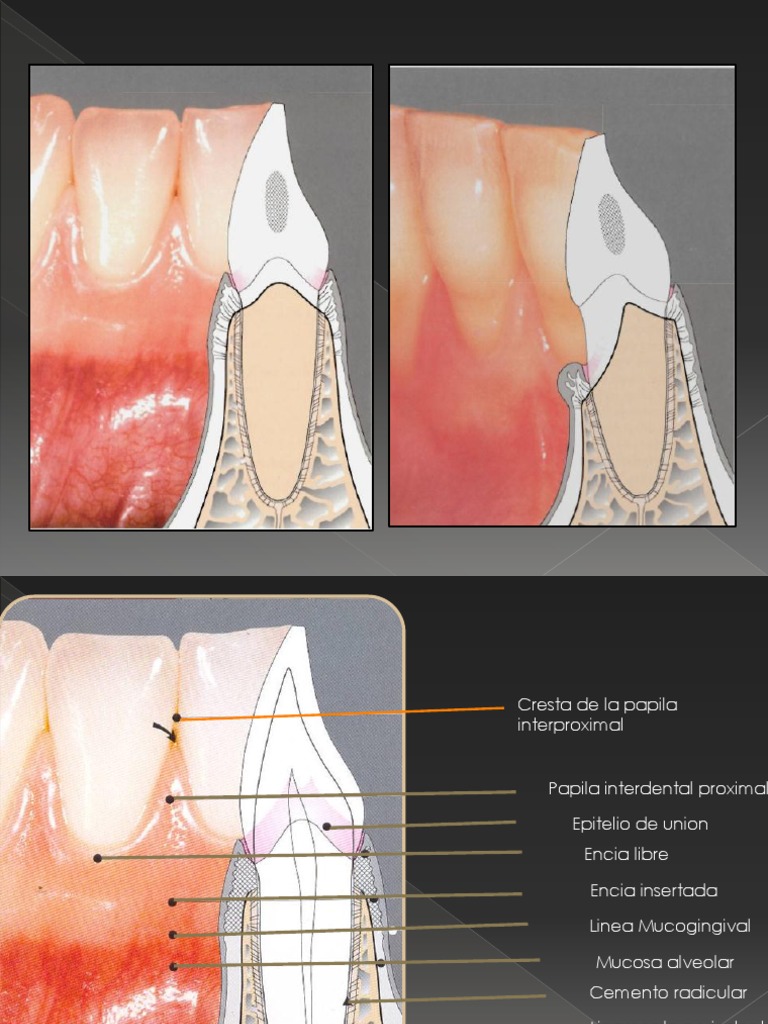 Anatomia Periodonto Normal | Diente humano | Hueso