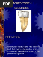 Management of Supraerupted Teeth | PDF | Tooth | Dentistry