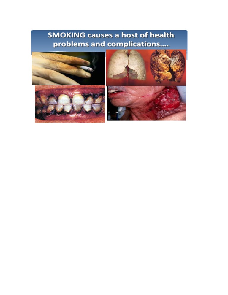 Health Risks of Smoking Explained | PDF