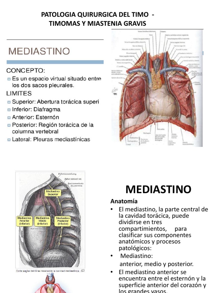 Timoma Cirugia | PDF | Timo | Zoología