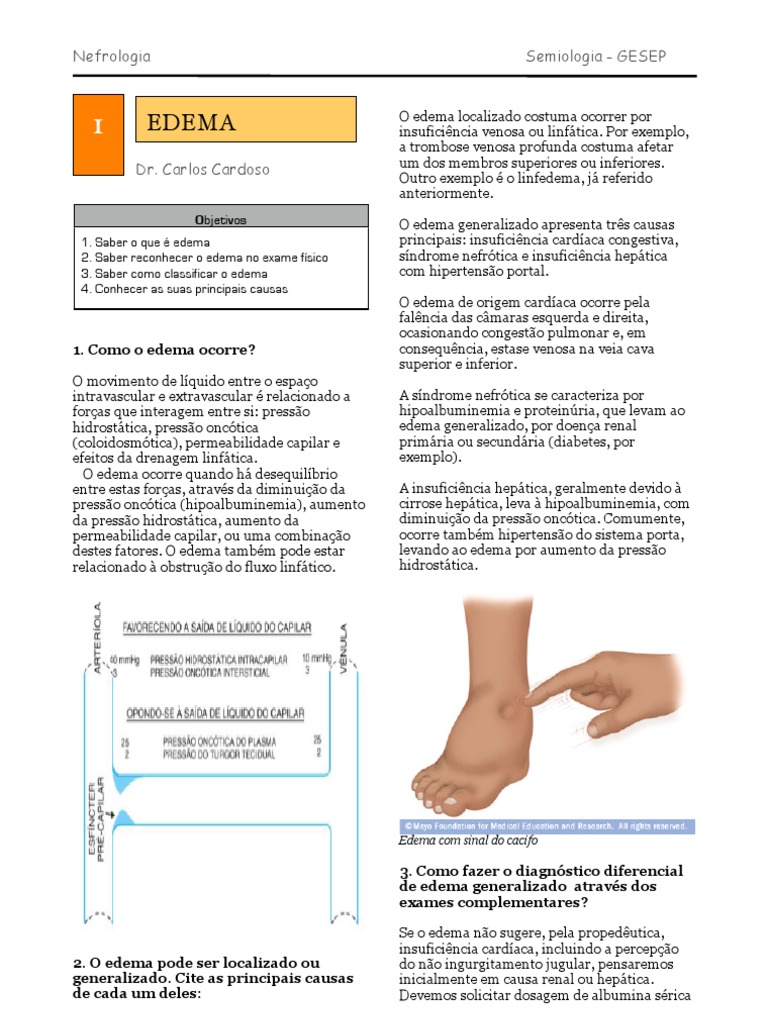 Edema Pdf Edema Hipertensão