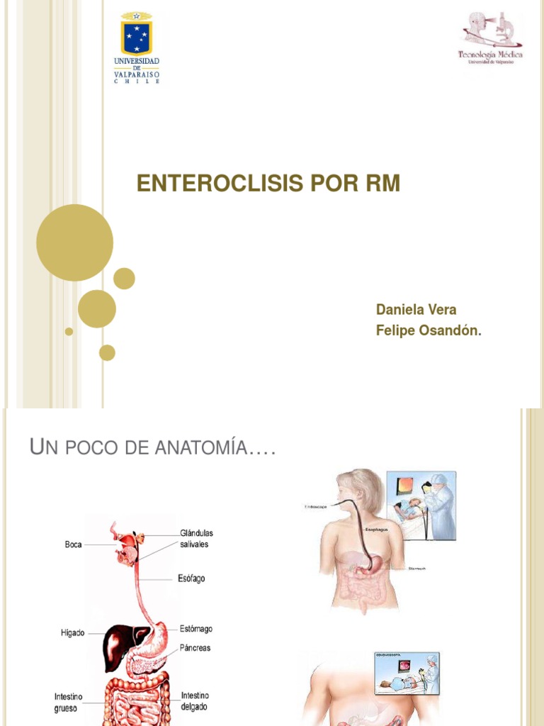 Enteroclisis Por RM | PDF