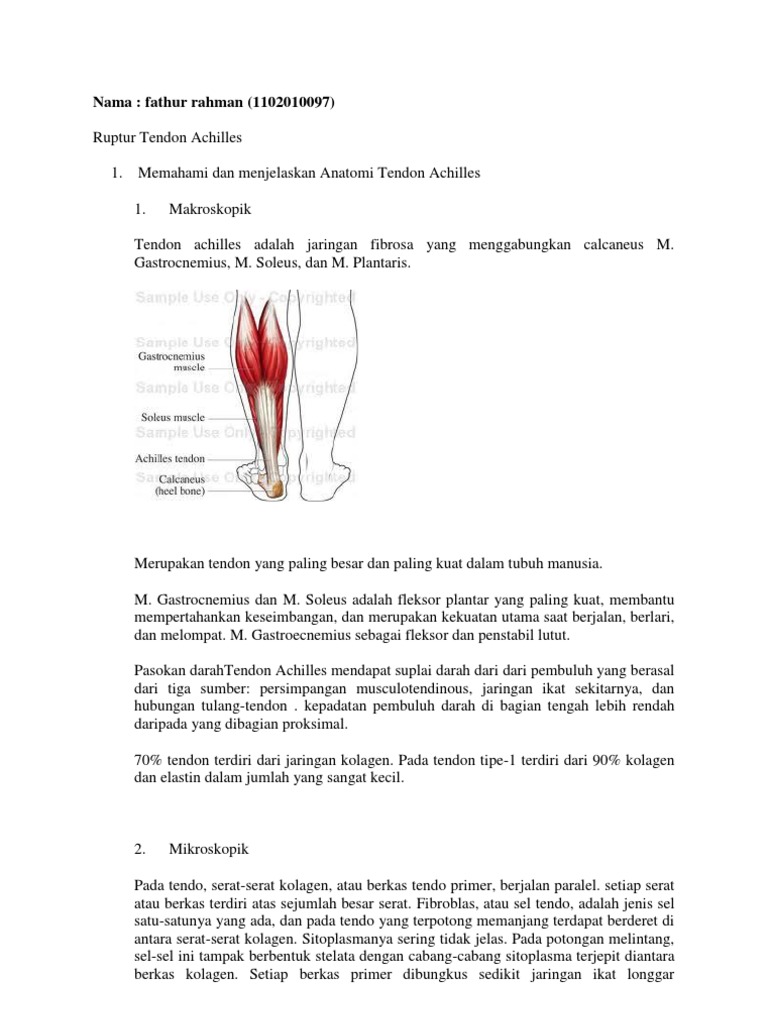 Ruptur Tendon Achilles | PDF | Kesehatan Holistik