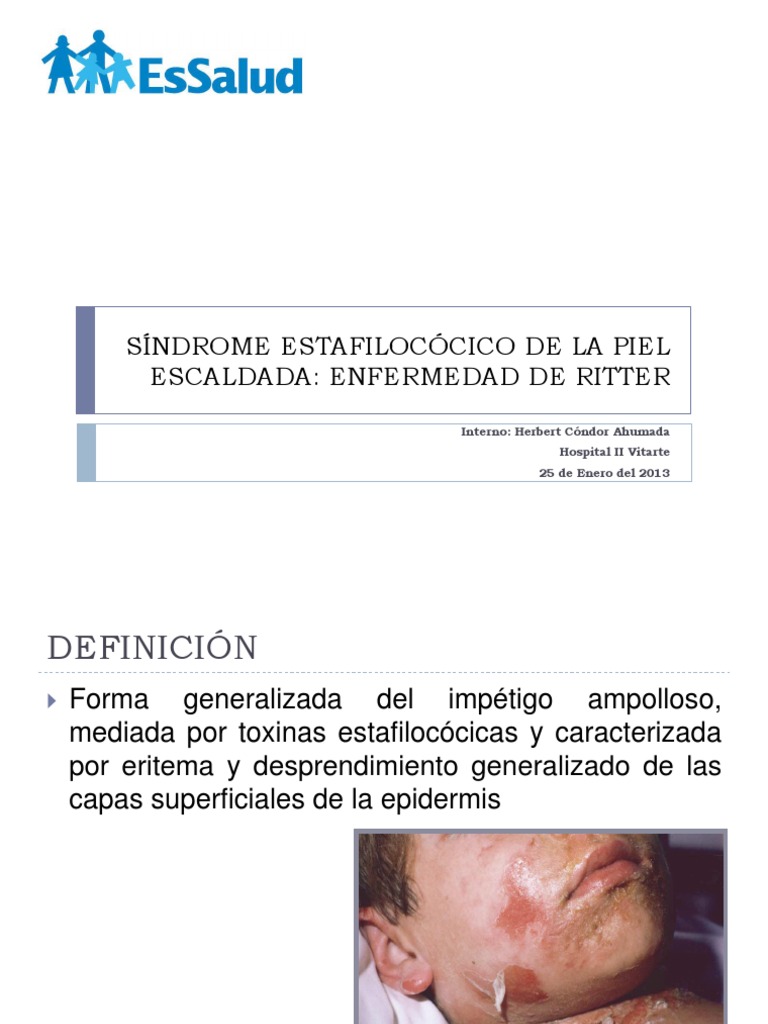 Síndrome Estafilocócico de La Piel Escaldada | PDF | Medicina ...
