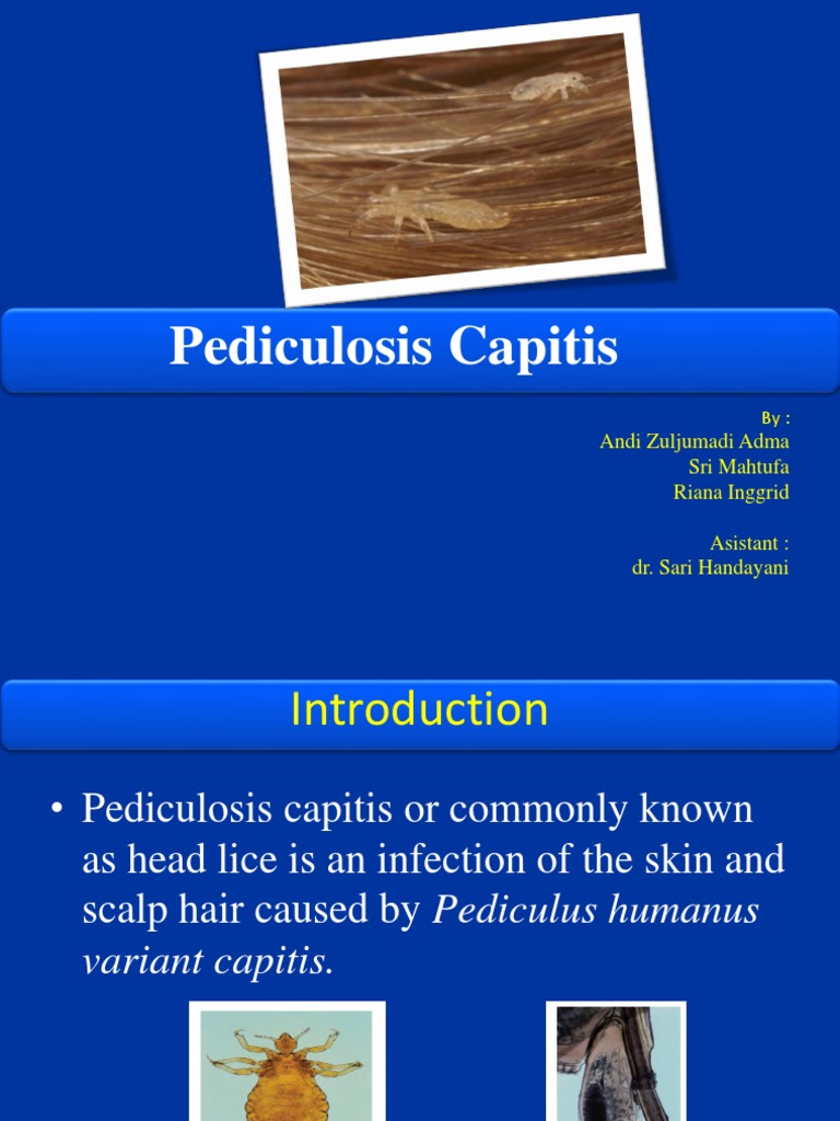 Pediculosis Capitis 22222 | Parasitology | Parasites