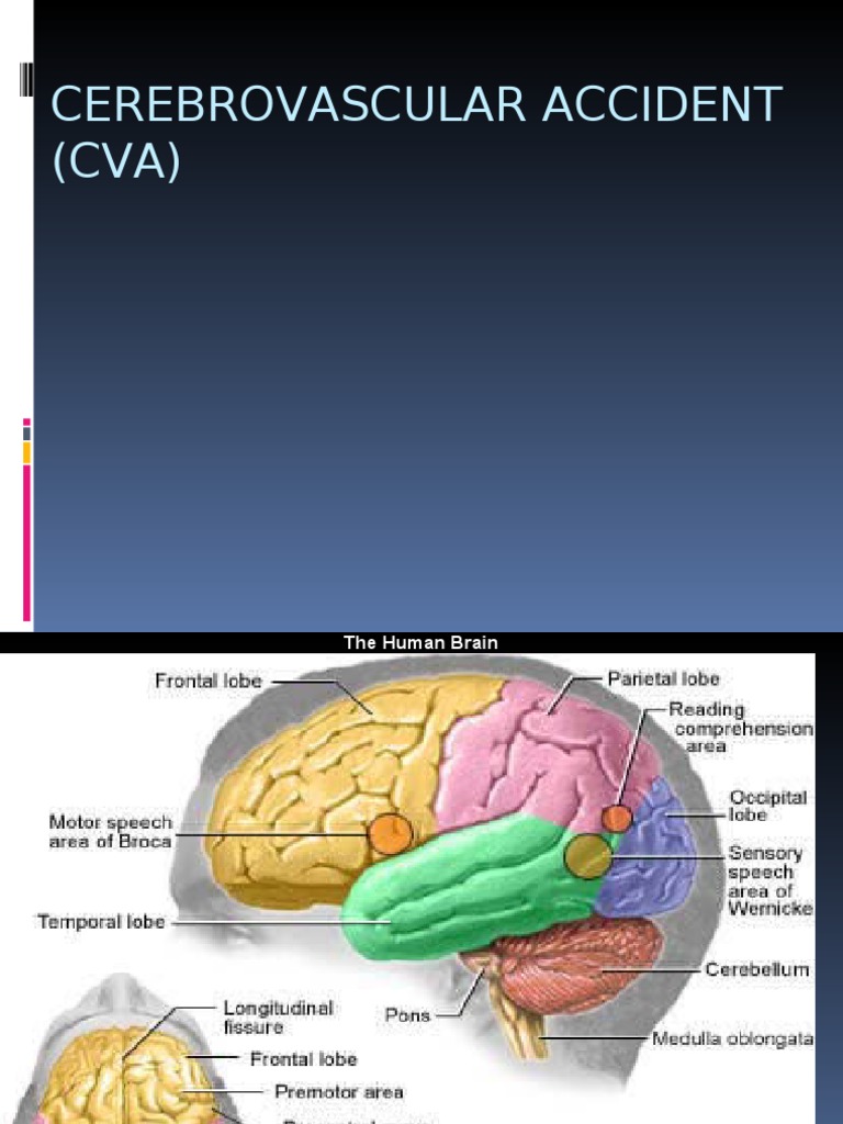 Understanding Cerebrovascular Accidents | PDF | Stroke | Ischemia
