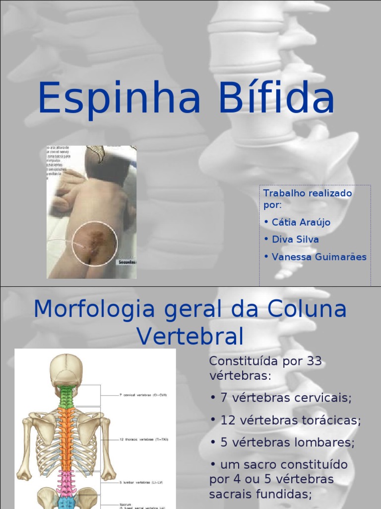 Espinha_Bifida apresentação | Coluna Vertebral | Anatomia dos Primatas ...