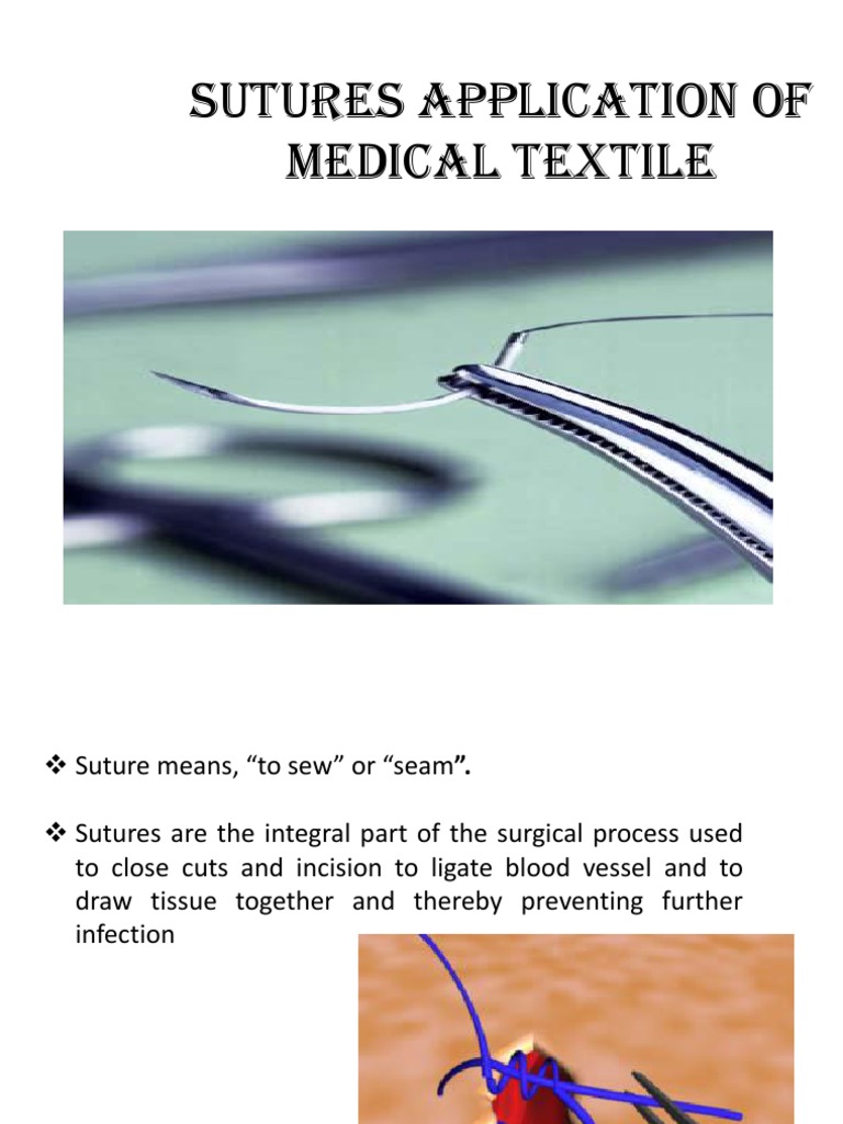 The Fundamentals of Suture Selection and Application: A Comprehensive ...