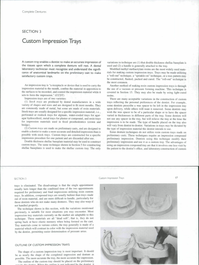 Custom Impression Trays: Section 3 | PDF | Dentures | Mouth
