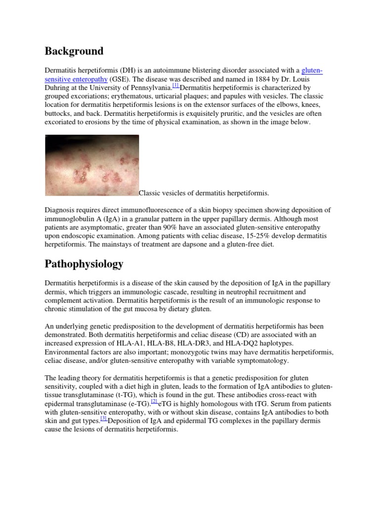 Dermatitis Herpetiformis | Medical Specialties | Immunology