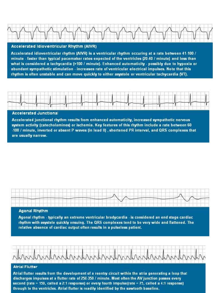 ECG Readings | PDF