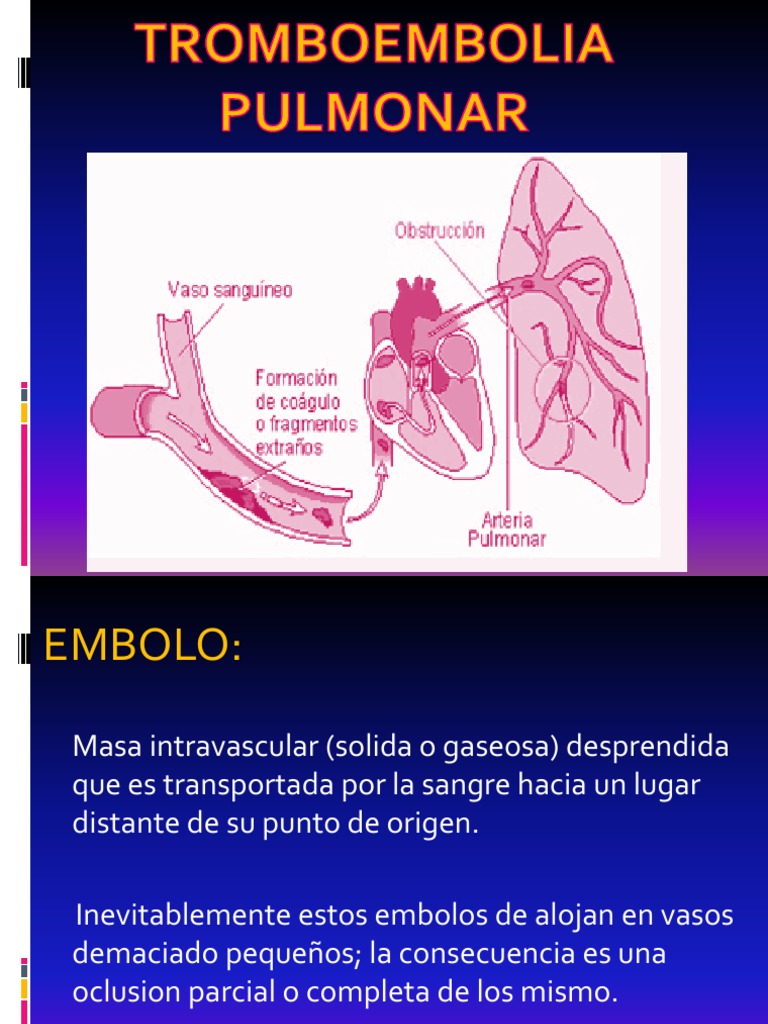 TROMBOEMBOLIA PULMONAR.pptx | Embolia | Trombo