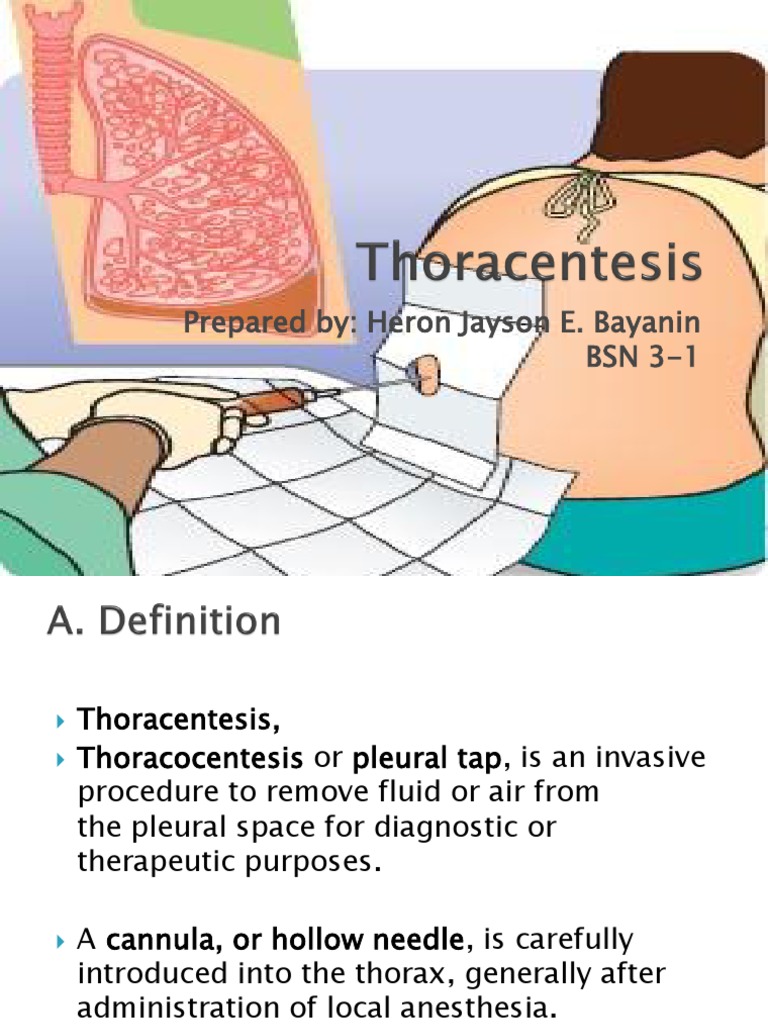 Thoracentesis | PDF | Diseases And Disorders | Health Sciences
