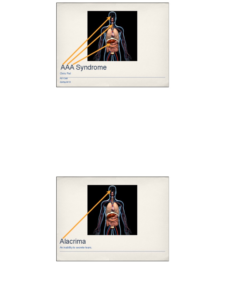 AAA Syndrome: Chris Piel | PDF | Adrenal Gland | Hyperglycemia
