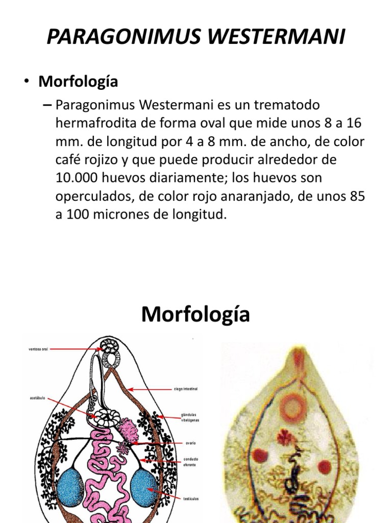 PARAGONIMUS WESTERMANI.pptx | Especialidades Medicas | Enfermedades y ...