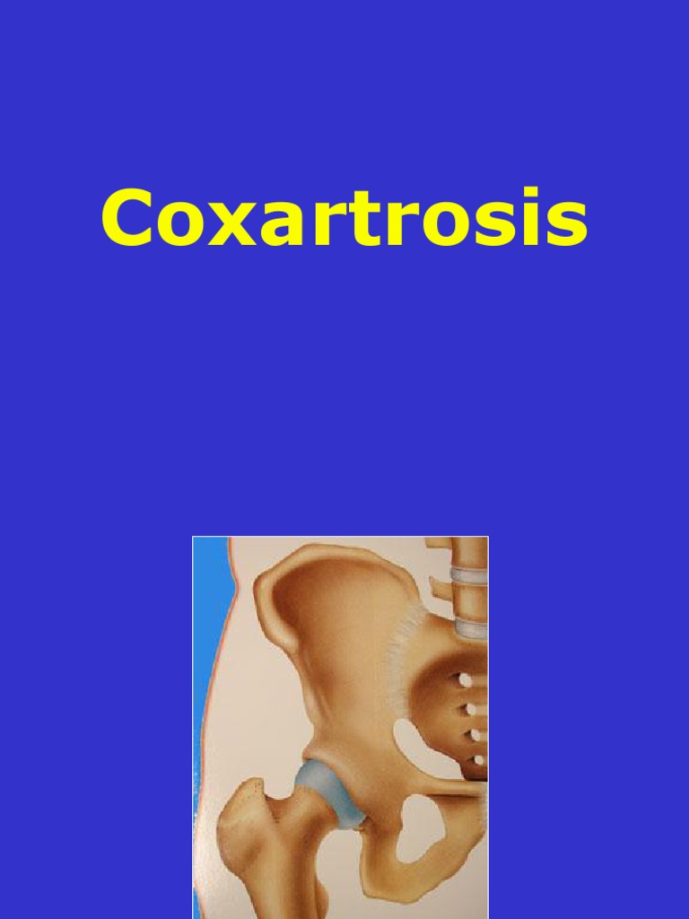 07- Coxartrosis | Rodilla | Cadera | Prueba gratuita de 30 días | Scribd