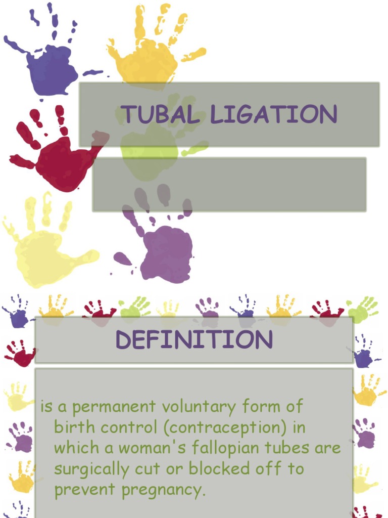 Tubal Ligation | PDF | Midwifery | Fertility