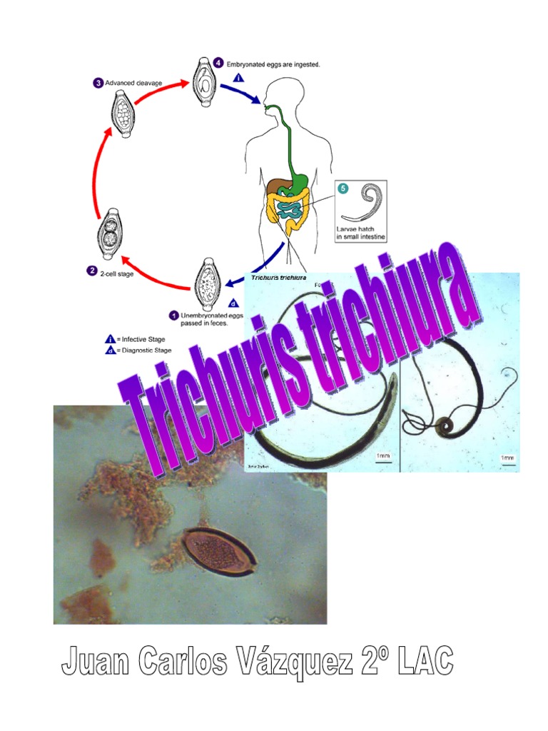 Trichuris Trichiura | PDF | Salud y bienestar | Medicina