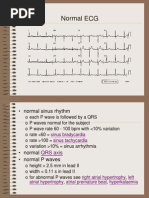 12-Lead EKG Interpretation | PDF