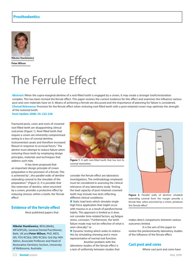 Ferrule Effect | PDF | Dental Composite | Dentistry Branches