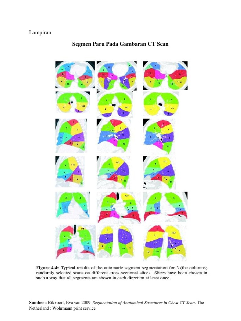 Segmen Paru Pada Gambaran CT Scan | PDF