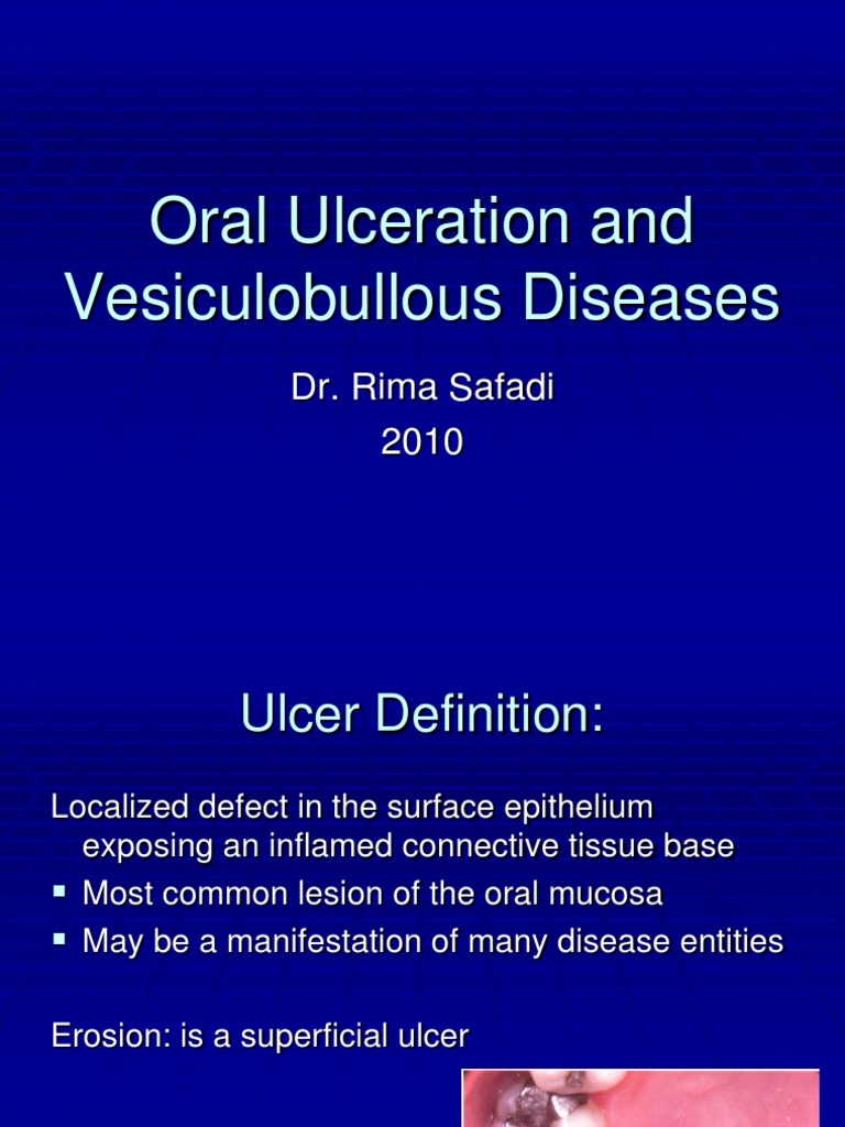 Oral Ulceration and Vesiculobullous Diseases1and 2 | PDF | Wellness ...