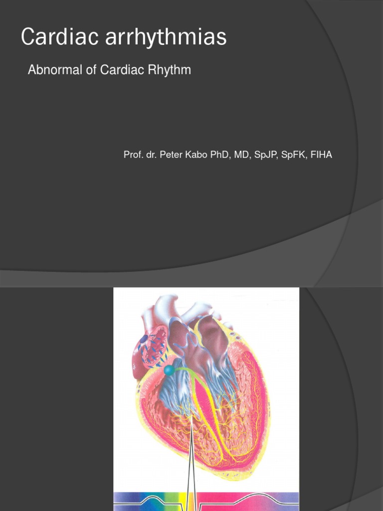 Cardiac Arrhythmias: Abnormal of Cardiac Rhythm | PDF | Cardiac ...