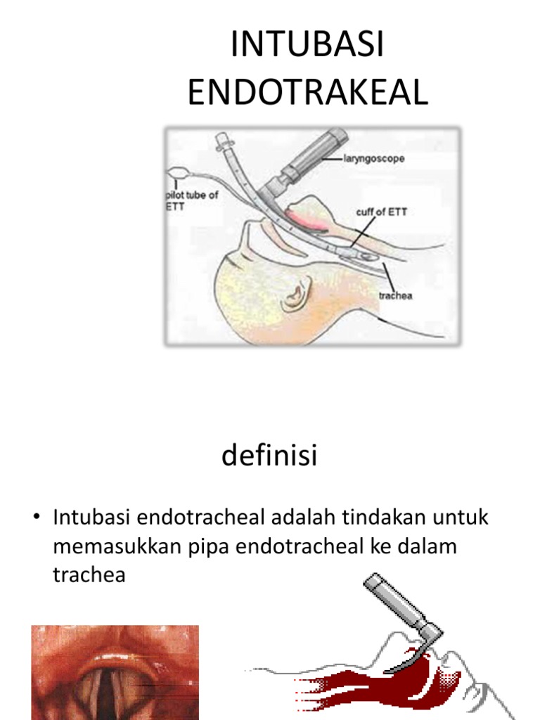 Ett Dan Trakeostomi | PDF | Kesehatan Holistik | Sains & Matematika