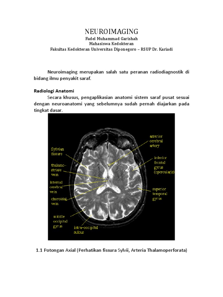 Neuroimaging Head CT Scan | PDF