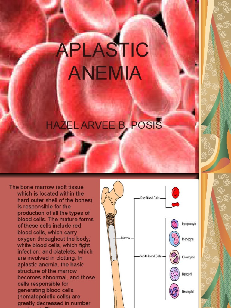Aplastic Anemia | PDF | Bone Marrow | Blood Cell