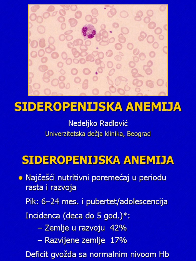Sideropenijska Anemija (Predavanje) | PDF